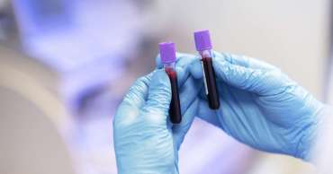 Arterial Blood Gas (ABG) Test Explained: Procedure, Normal Values ...